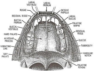 classification of soft palate and residual ridge | PPT