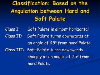 classification of soft palate and residual ridge | PPT