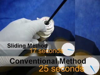 Introduce sliding technique | PPT | Surgery | Medical Health