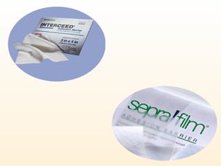 Introduce sliding technique | PPT | Surgery | Medical Health