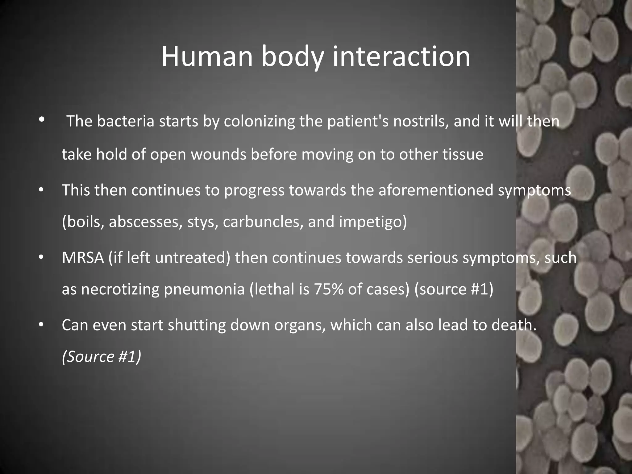 MRSA - Mobius Human Disease Project | PPT