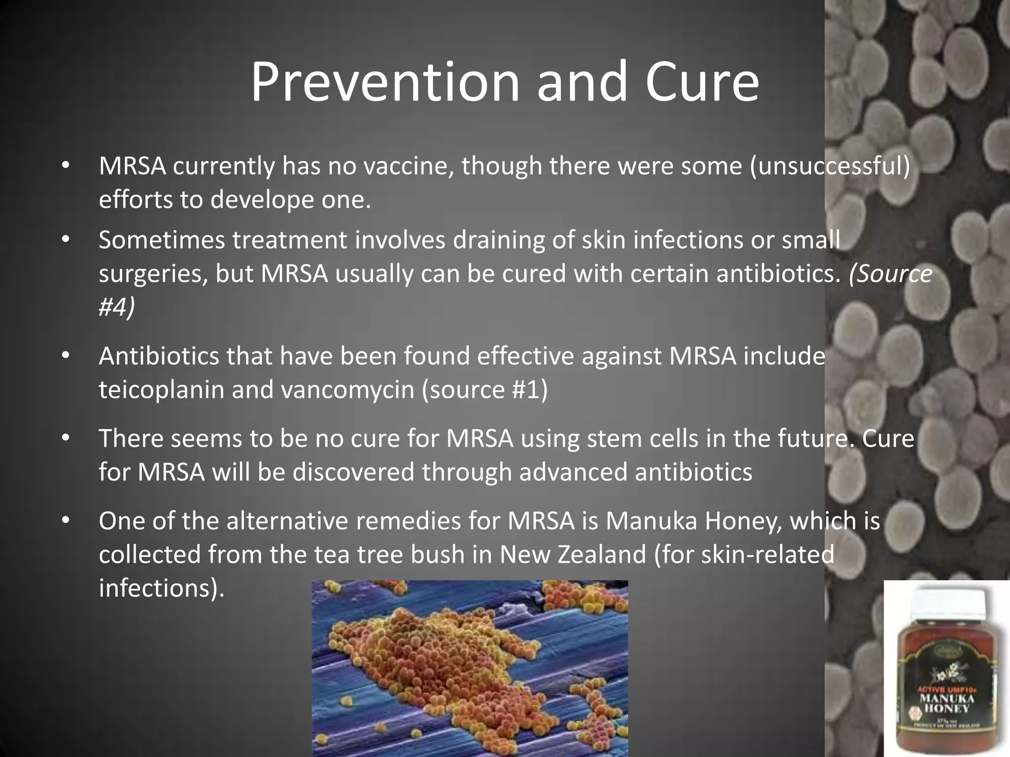 MRSA - Mobius Human Disease Project | PPT