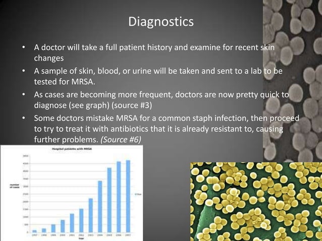 MRSA - Mobius Human Disease Project | PPT