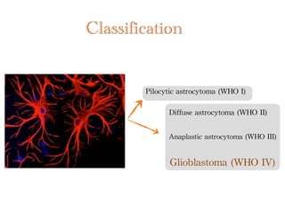 Glioblastoma | KEY
