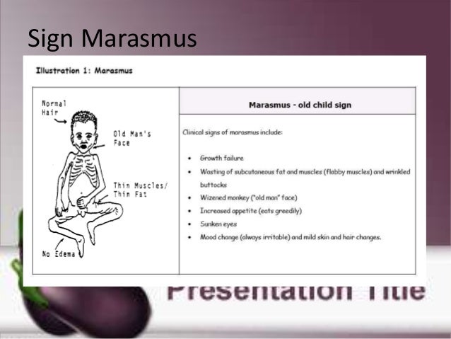 Protein Energy Malnutrition
