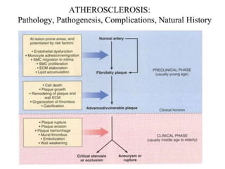 Arteriosclerosis - Homoeopathic & miasmatic view | PPT