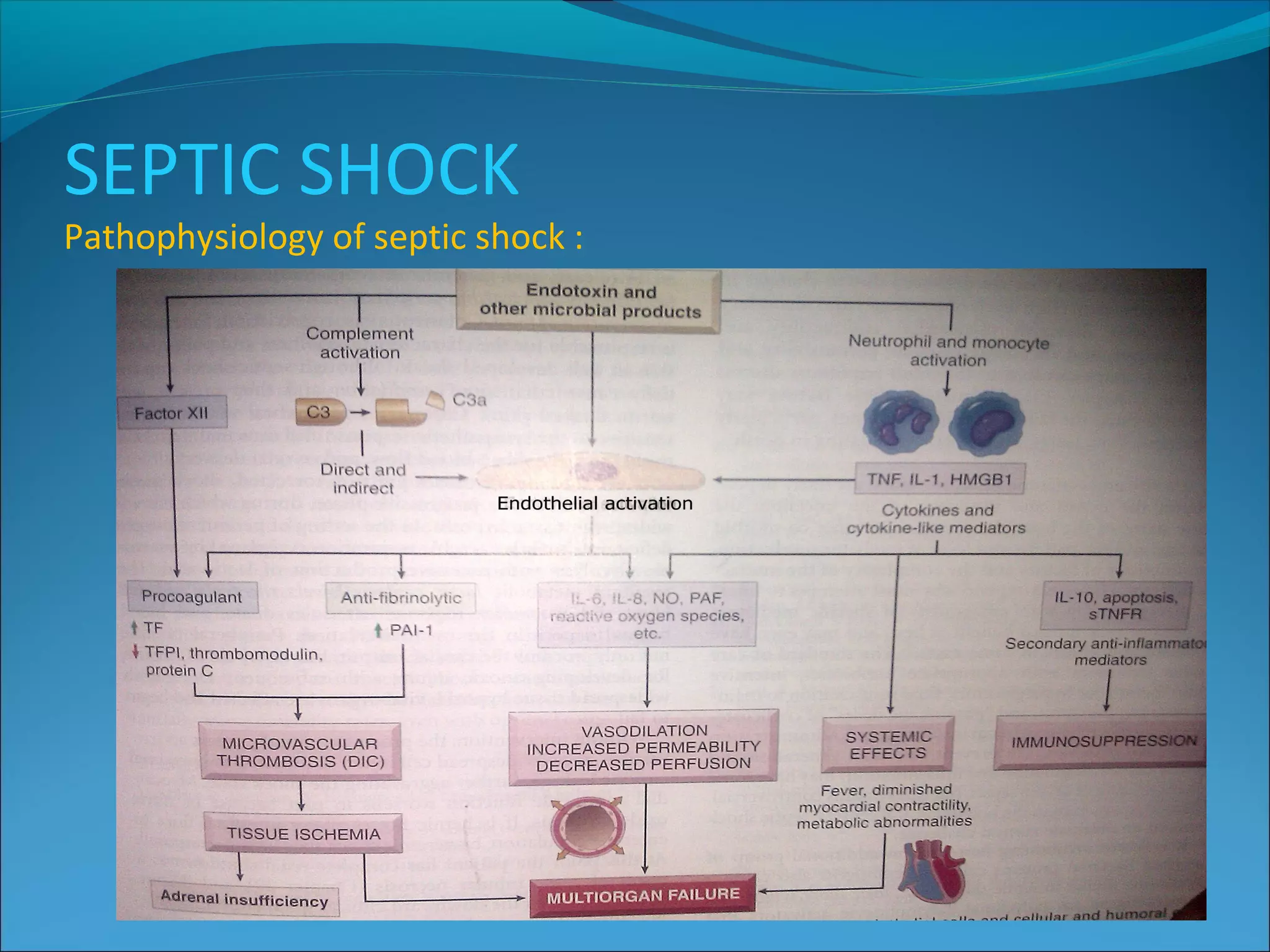 shock | PPT