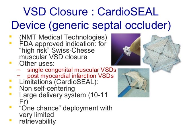 Presentation on heart valve devices
