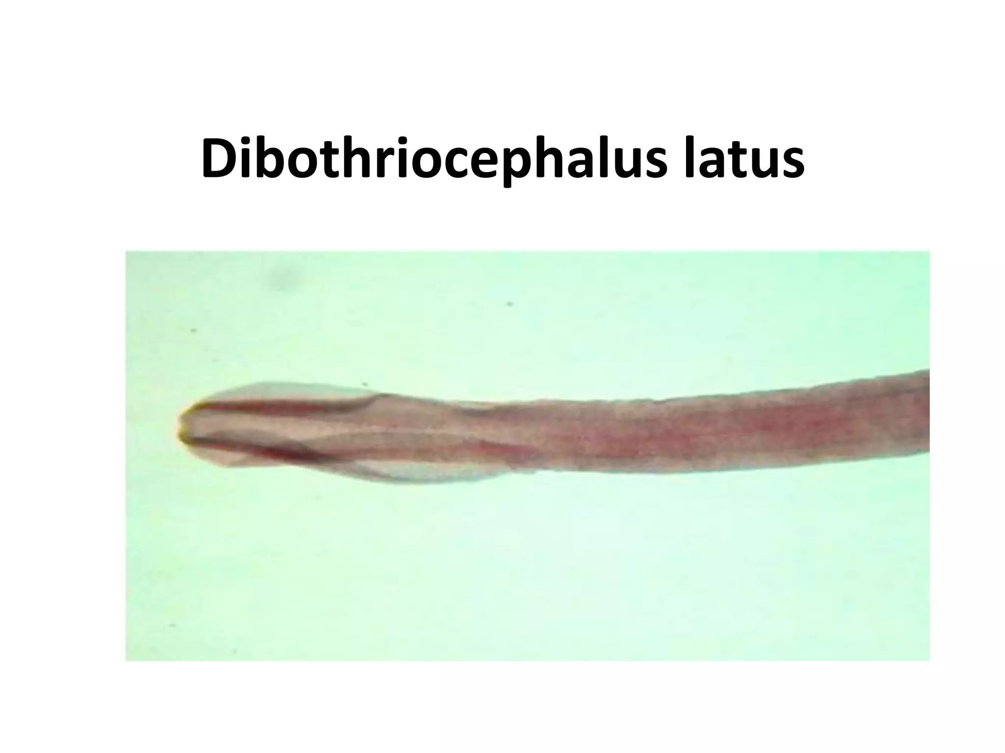 Diphyllobothrium Latum | PPTX