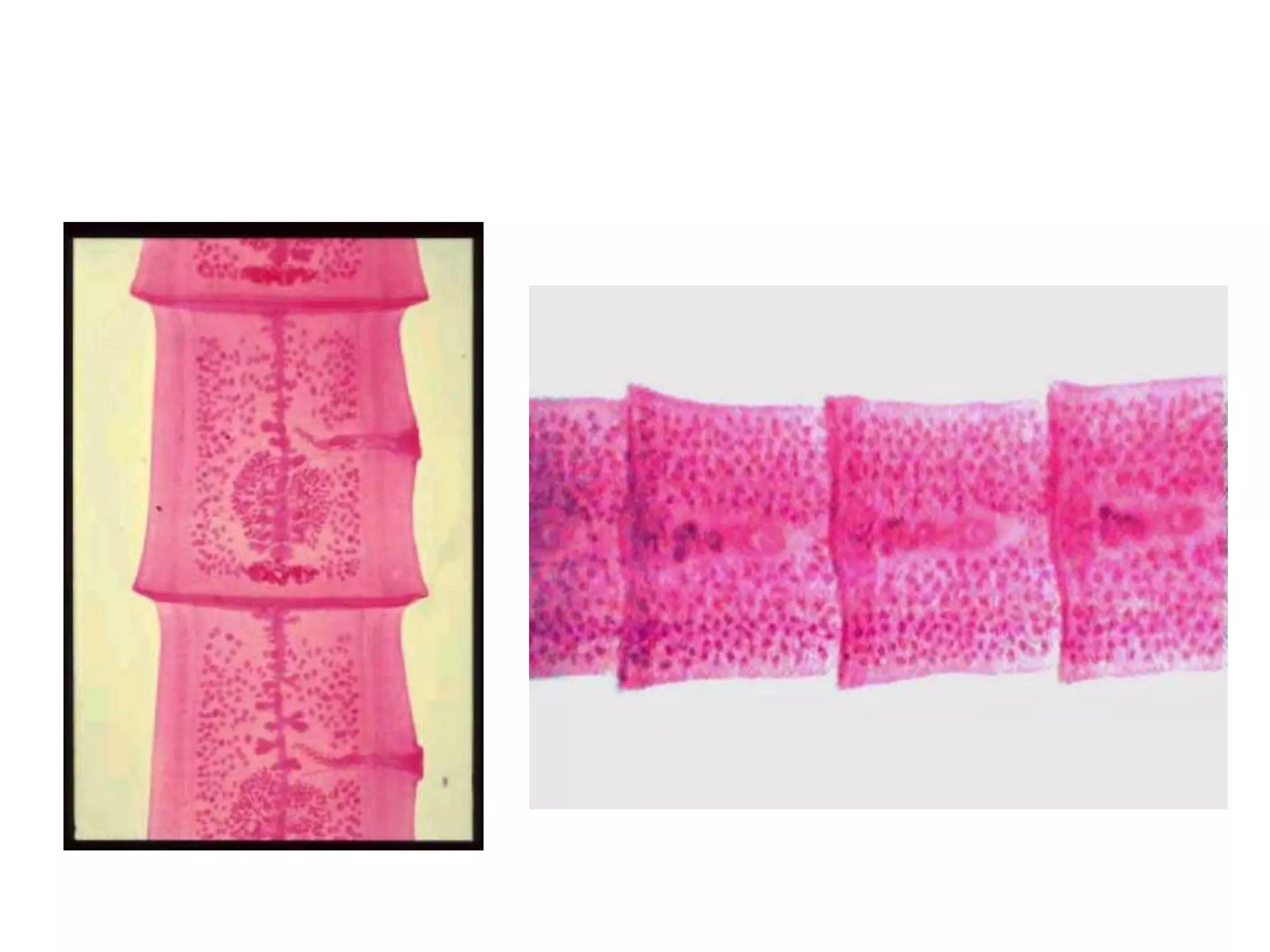 Diphyllobothrium Latum | PPTX