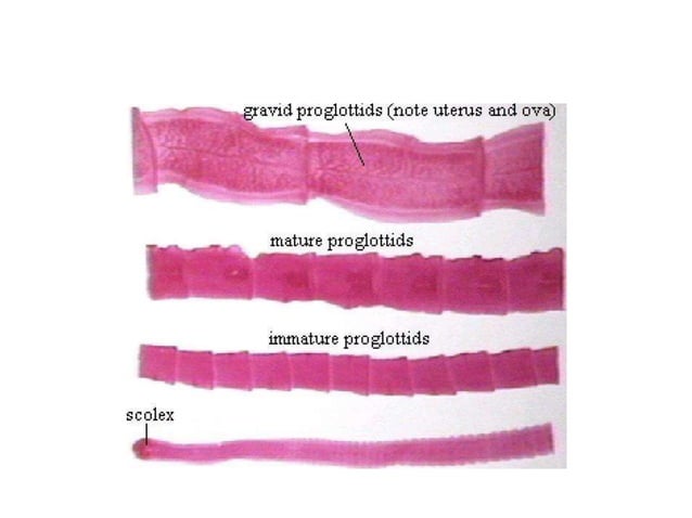 Diphyllobothrium Latum | PPTX