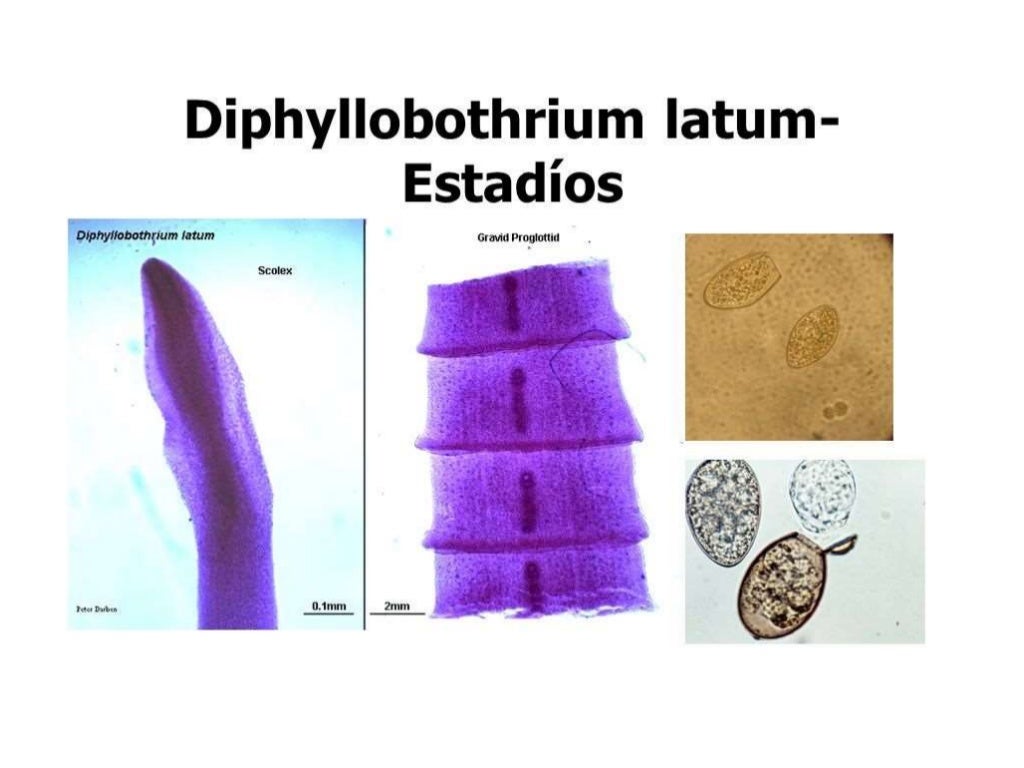 Diphyllobothrium Latum