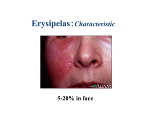 Gross Human Skin Diseases