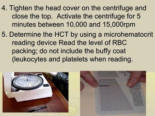 packed cell volume and blood indices | PPT