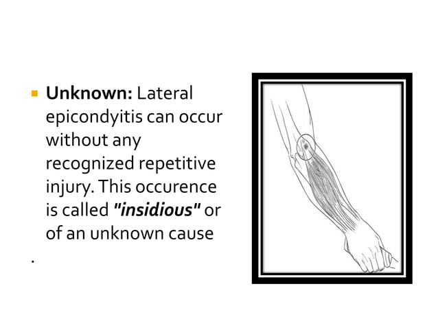 lateral & medial epicondylitis | PPTX