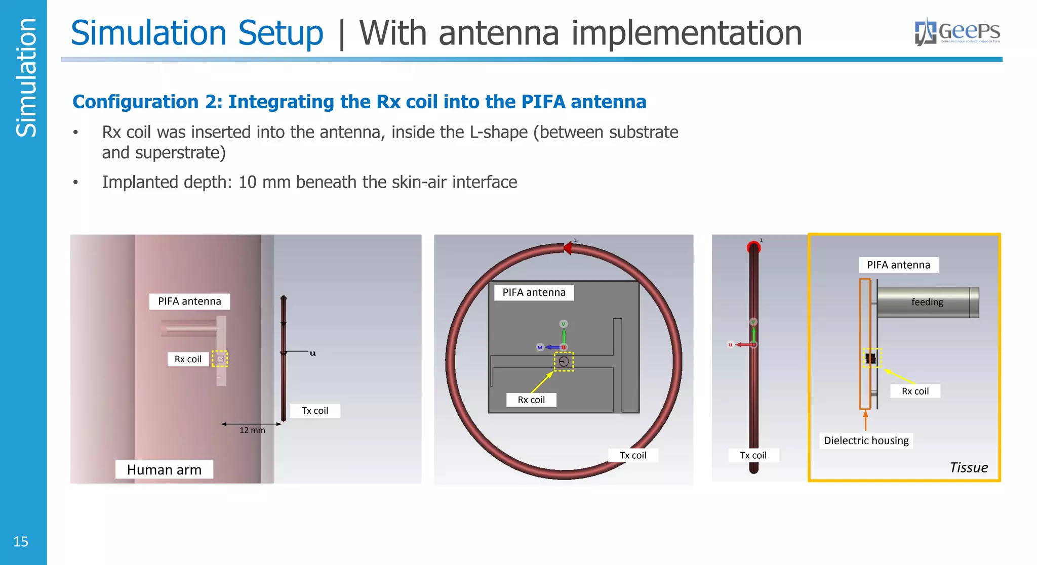 Wireless Power Transmission for Implantable Medical Devices | PDF