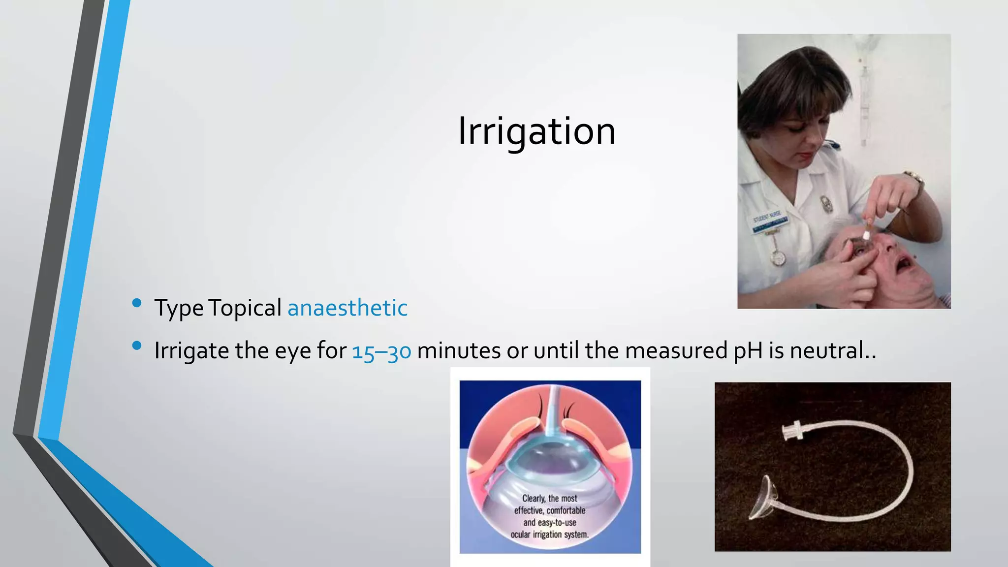 chemical eye injuries, approach and management | PPTX