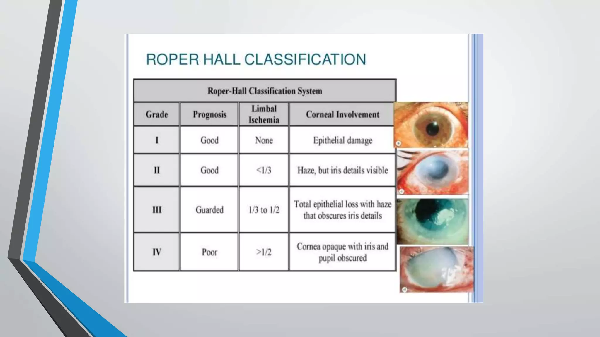 chemical eye injuries, approach and management | PPTX