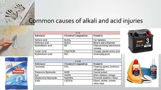 chemical eye injuries, approach and management | PPTX