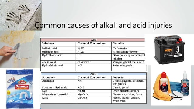chemical eye injuries, approach and management | PPTX | Eye and Vision ...