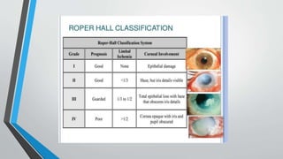 chemical eye injuries, approach and management | PPTX