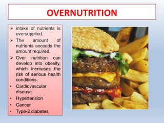 Malnutrition | PPTX