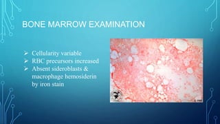 Diagnosis of iron deficiency anemia | PPTX
