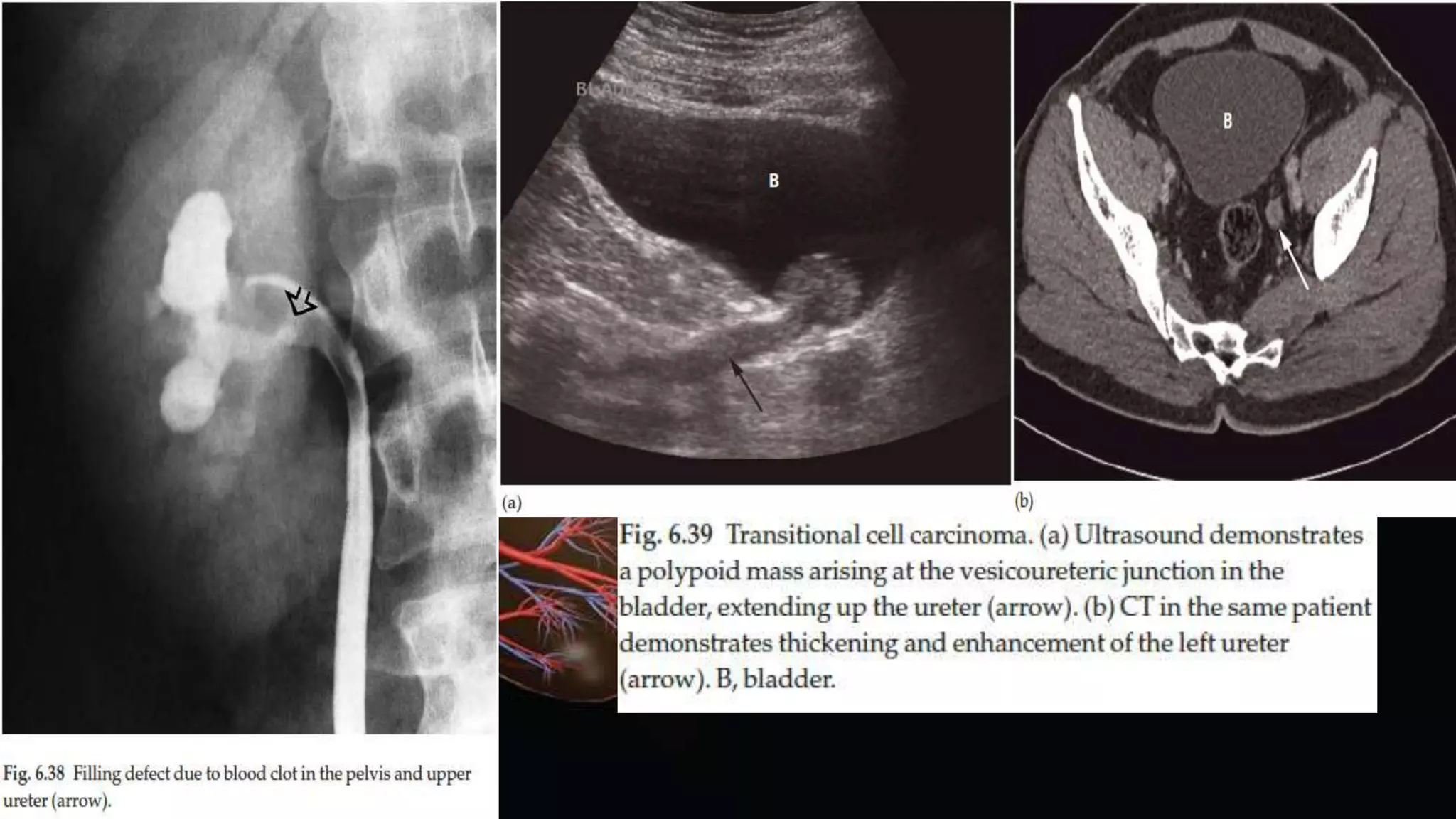 urinary tract radiology | PPT