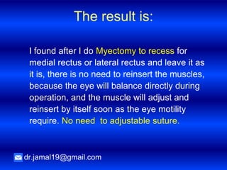 Myectomy non-suture technique for large angle strabismus surgery | PPT