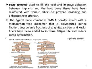 application of composite material in biomedical fild | PPTX