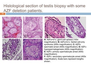 Insight into AZF region of y chromosome and male infertility | PPTX