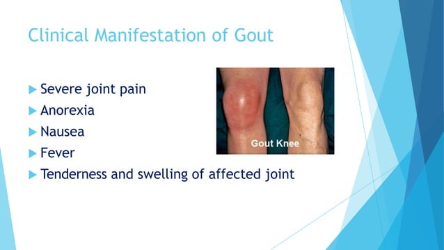 Drug therapy of gout | PPTX | Chemistry | Science