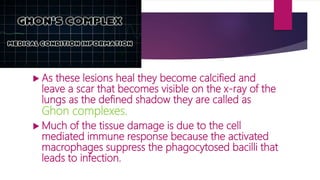 Immune Resopnse to Tuberculosis | PPTX