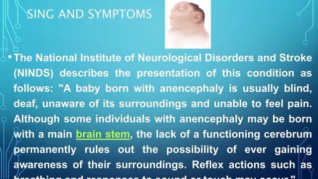 Congenital Abnormalities neuro | PPT