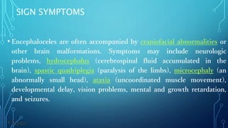 Congenital Abnormalities neuro | PPTX