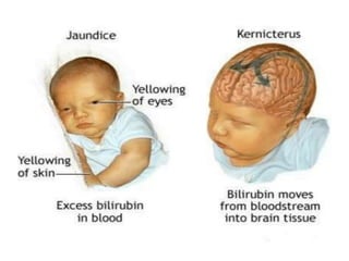 High Risk Conditions in Newborn | PPTX