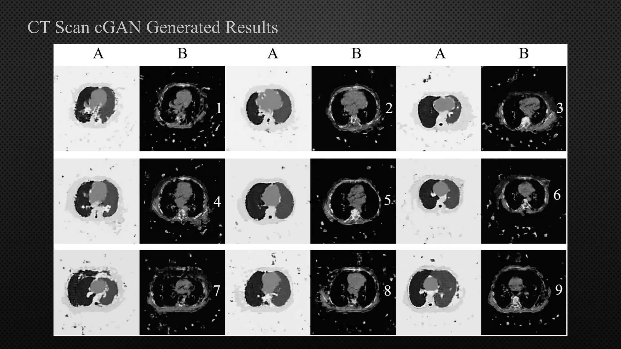 CT Scan Synthesis | Tejas Prabhune | PPTX