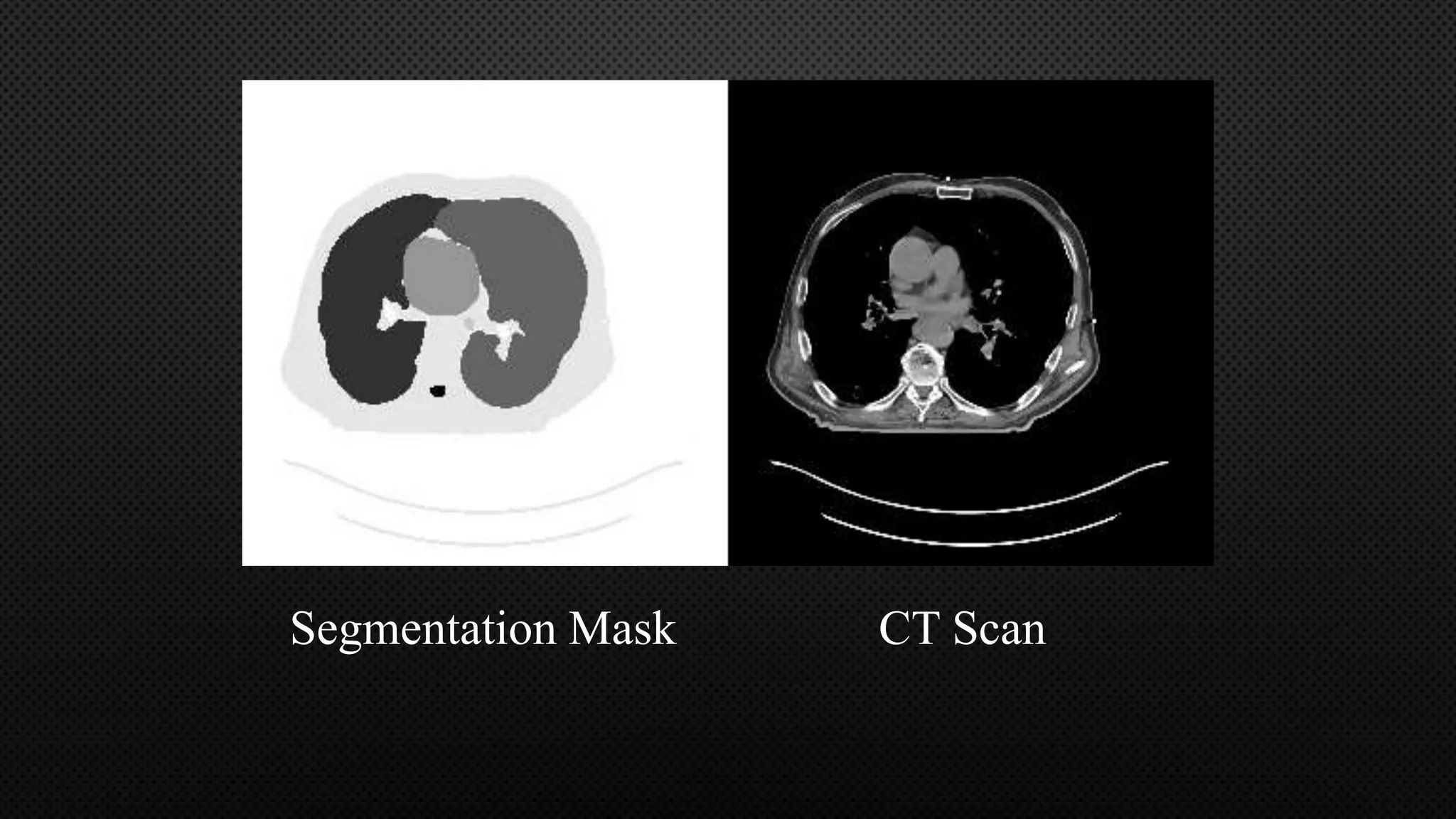 CT Scan Synthesis | Tejas Prabhune | PPTX
