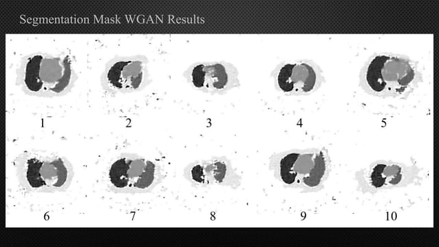 CT Scan Synthesis | Tejas Prabhune | PPT