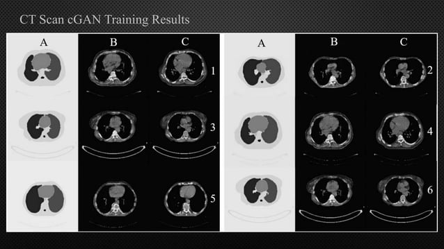 CT Scan Synthesis | Tejas Prabhune | PPT