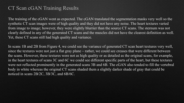 CT Scan Synthesis | Tejas Prabhune | PPT