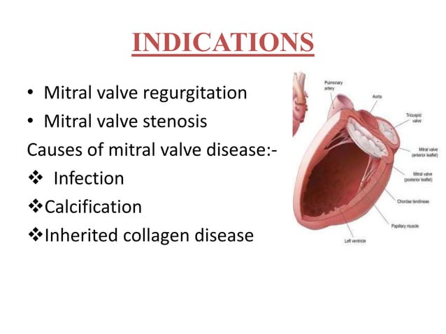 Mitral valve replacement | PPTX | Heart and Cardiovascular Diseases ...