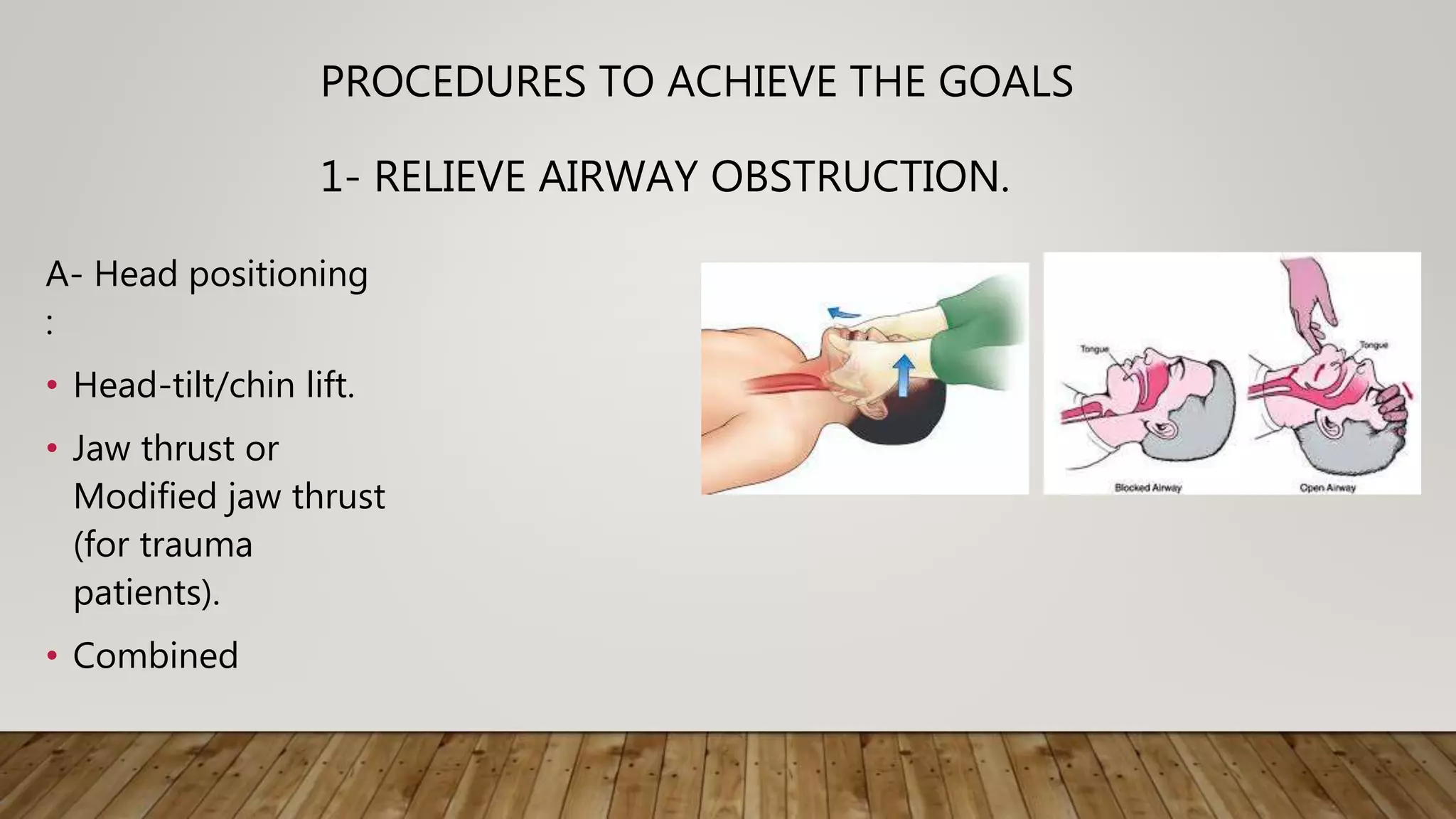 Basic Airway Management | PPTX