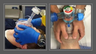 Basic Airway Management | PPTX