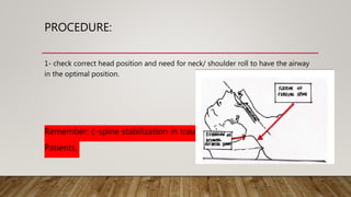 Basic Airway Management | PPTX