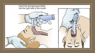 Basic Airway Management | PPTX