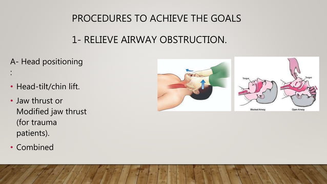 Basic Airway Management | PPTX | Ear, Nose and Throat Conditions ...