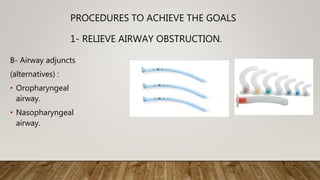 Basic Airway Management | PPTX