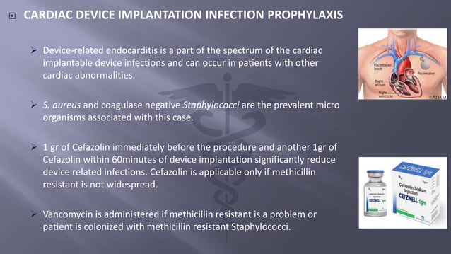 Antibiotics prophylaxis for Infective Endocarditis | PPTX