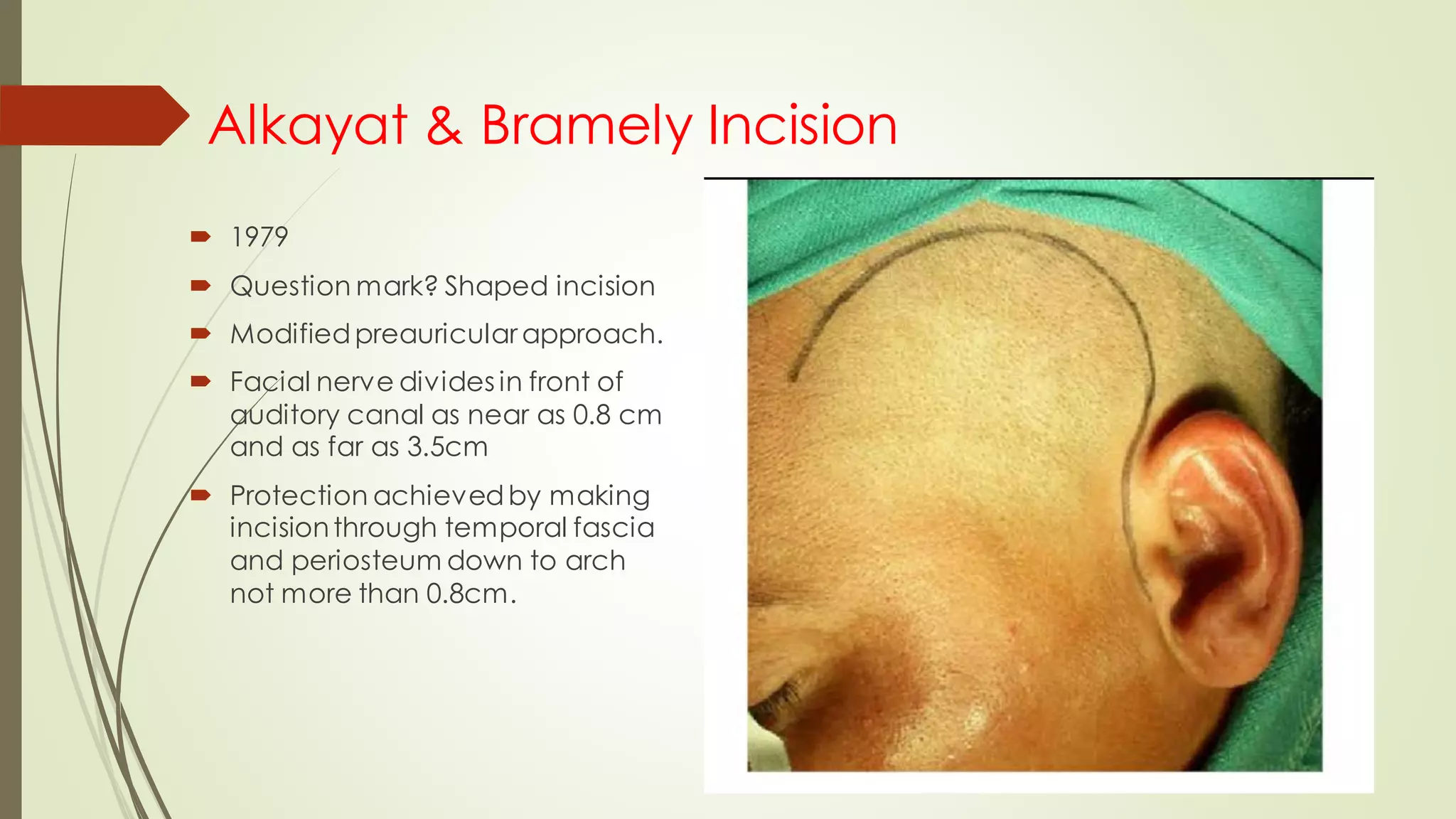 Extraoral Surgical Approaches to Temporomandibular Joint | PDF